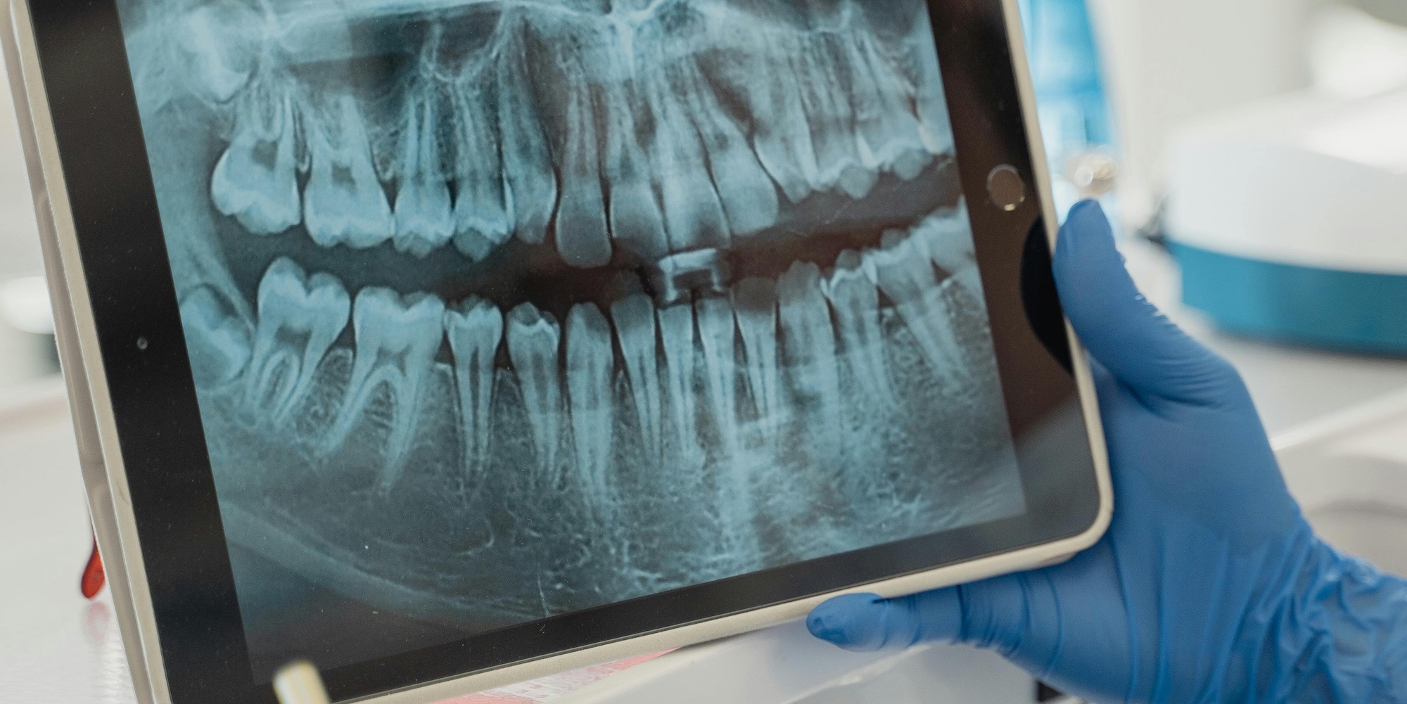Dealing with Tooth Ache - Dr B. Dentistry